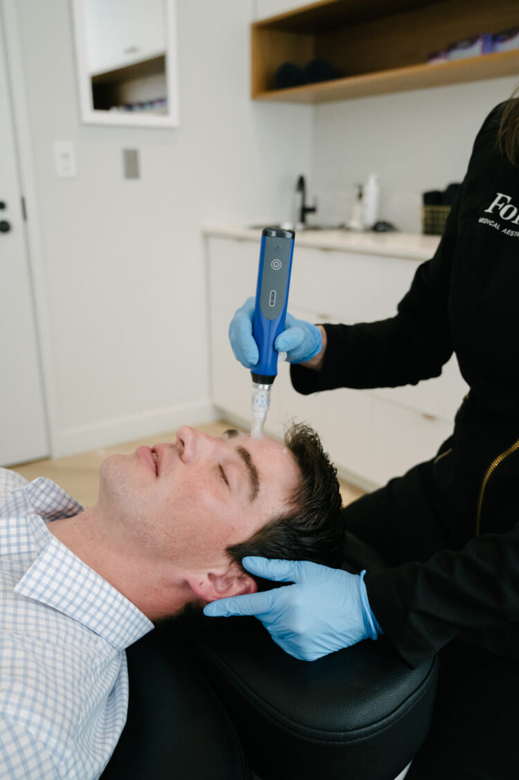 Microneedling (SkinPen) – Form Medical Aesthetics